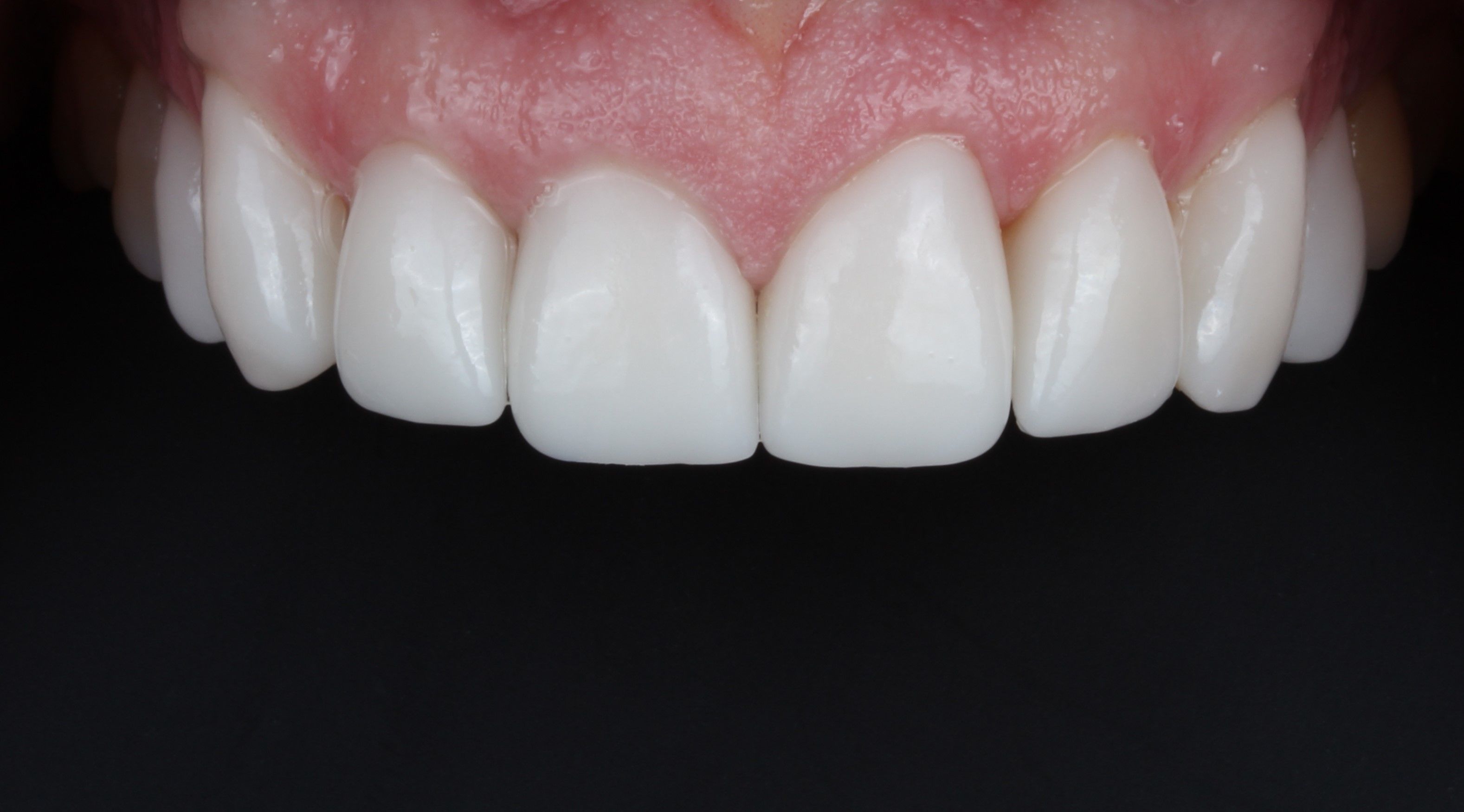 Dentist Caloundra | Caloundra Dental Clinic | Local Dental